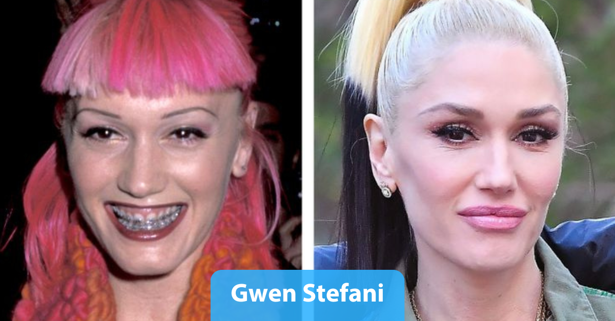 90. roky vs. dnes – takto sa zmenili niektoré celebrity