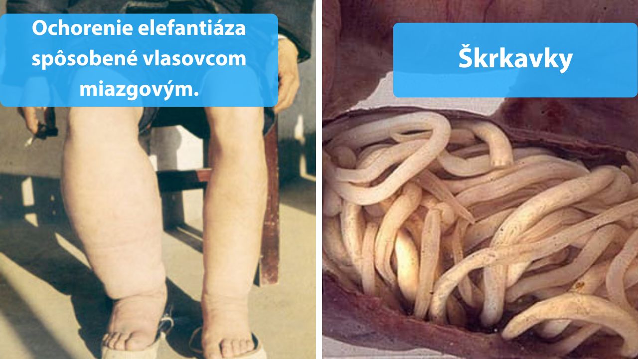 Parazity, ktoré by ste si mohli priniesť z dovolenky, niektoré druhy sa ...