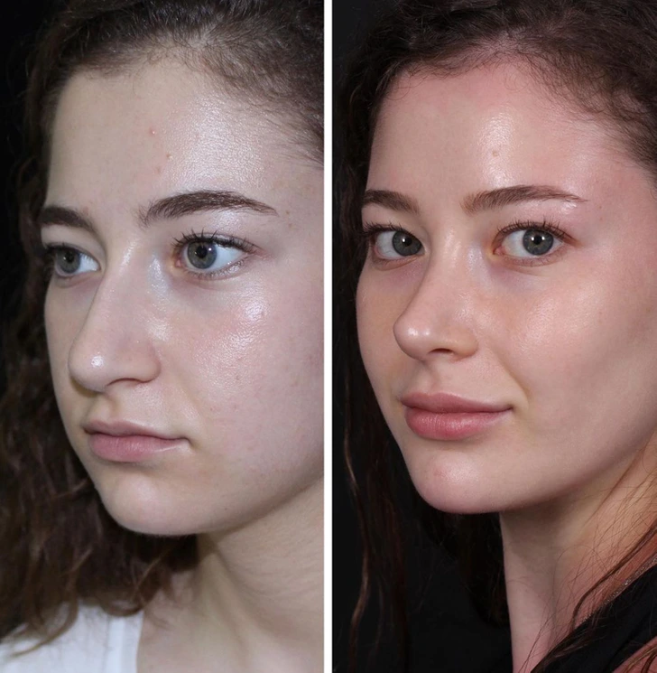 10 ľudí, ktorí sa rozhodli ukázať, ako vám vie plastická operácia ...