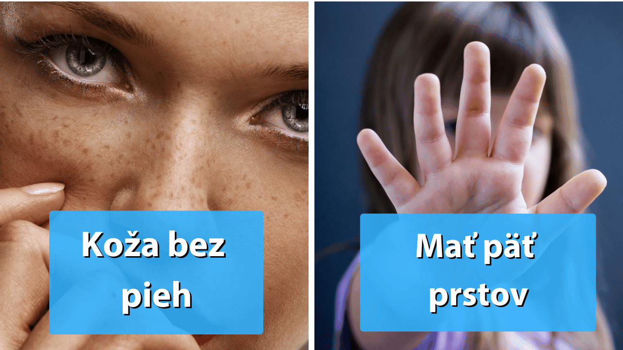 Rozbíjanie mýtov o recesívnych génoch: Najbežnejšie ľudské ...