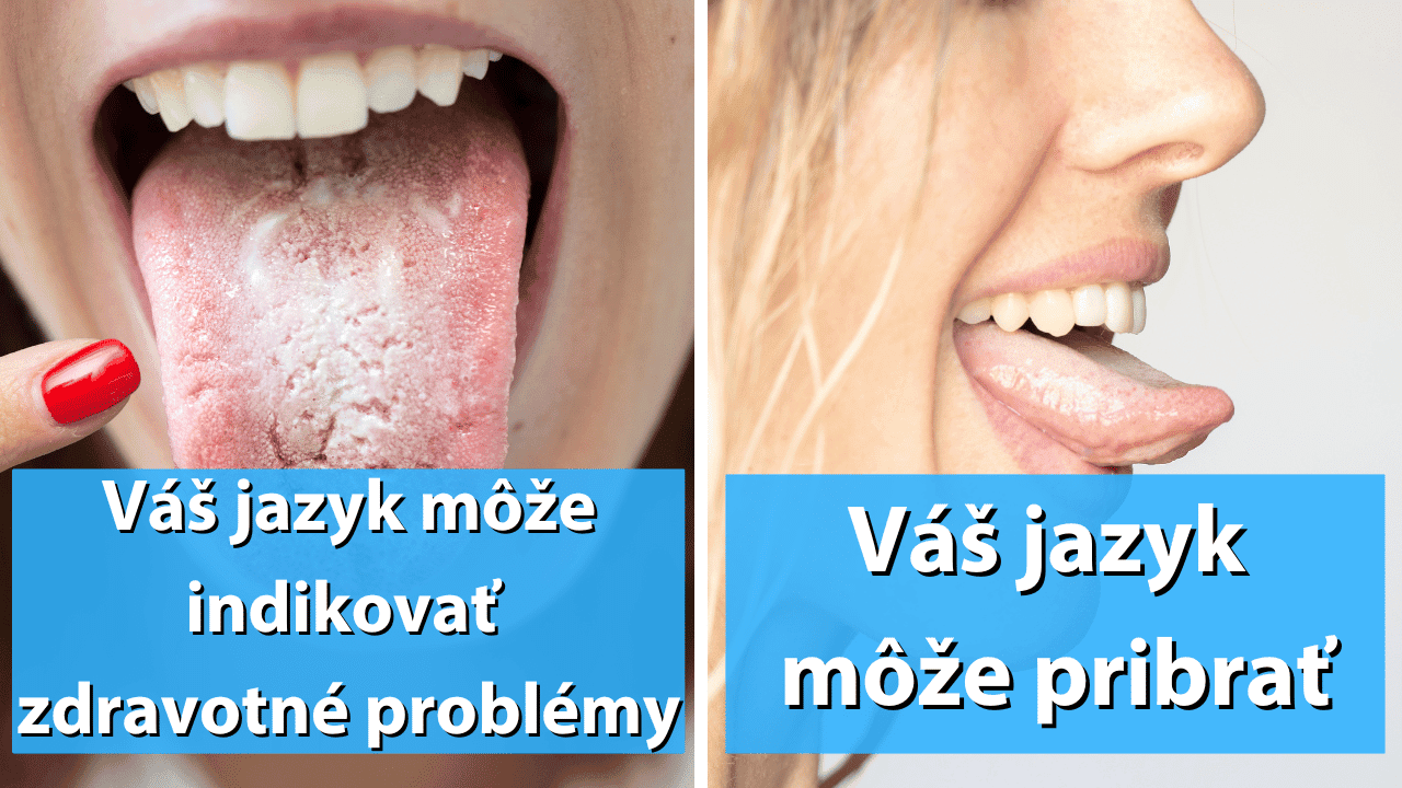 Prekvapujúce tajomstvá vášho jazyka: Zopár zvláštnych faktov o vašom ...