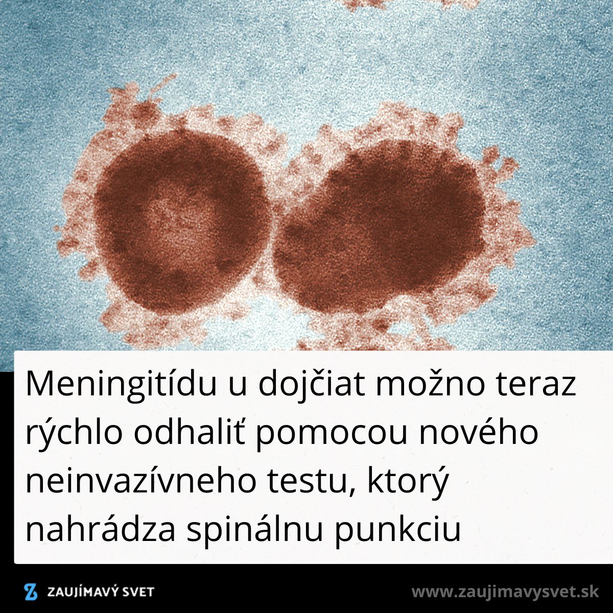 5 pozitívnych správ pre dušu, ktoré ti vrátia vieru v ľudstvo #14 ...
