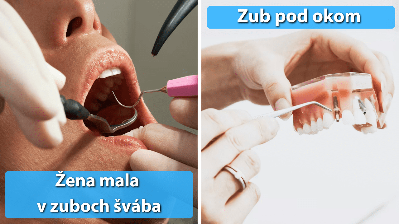 10 prípadov, keď mali zubári čo robiť, aby skryli svoje znechutenie